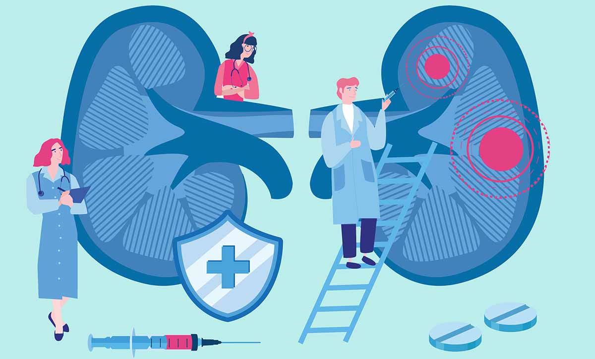 Detectar la insuficiencia renal aguda desde la farmacia | Teva