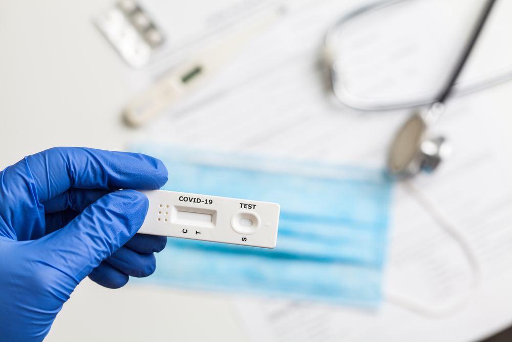 Las farmacias de Ourense realizan test serológicos de la COVID-19 | Teva